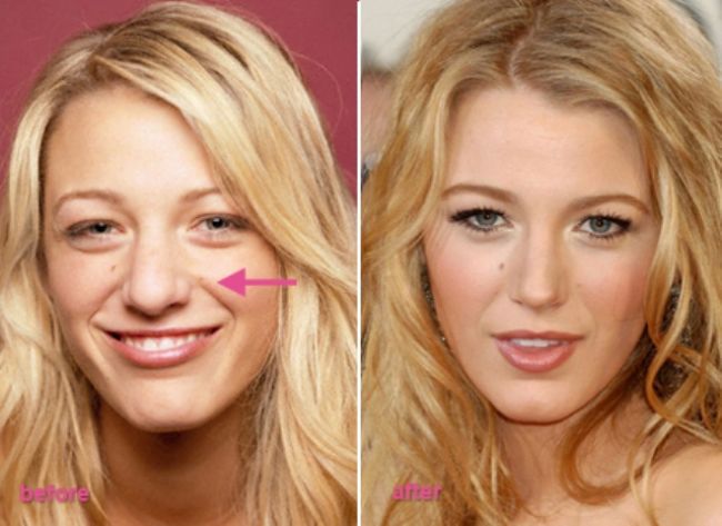 Blake Lively, pe vremea cand nu era perfecta. Vezi cum arata actrita ...